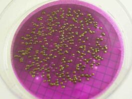 Análise de bactérias coliformes na água: por que fazer? | Lamattina ...